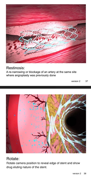 Storyboards: The Key to Successful Litigation Animations